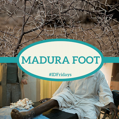 #IDFridays Week 19: Madura Foot – DRASA